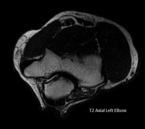 MRI Scan Images | Worcestershire Imaging Centre | Worcester MRI Scans